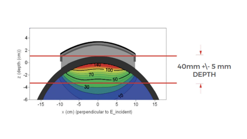 ALBA ON4000D - 알바온
